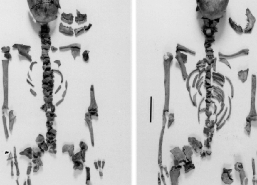 Distinguishing between multiple skeletons at the Osteological Analysis ...